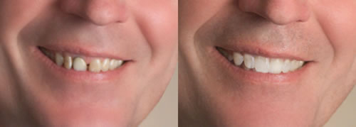 Photo Retouch - ADV Photo